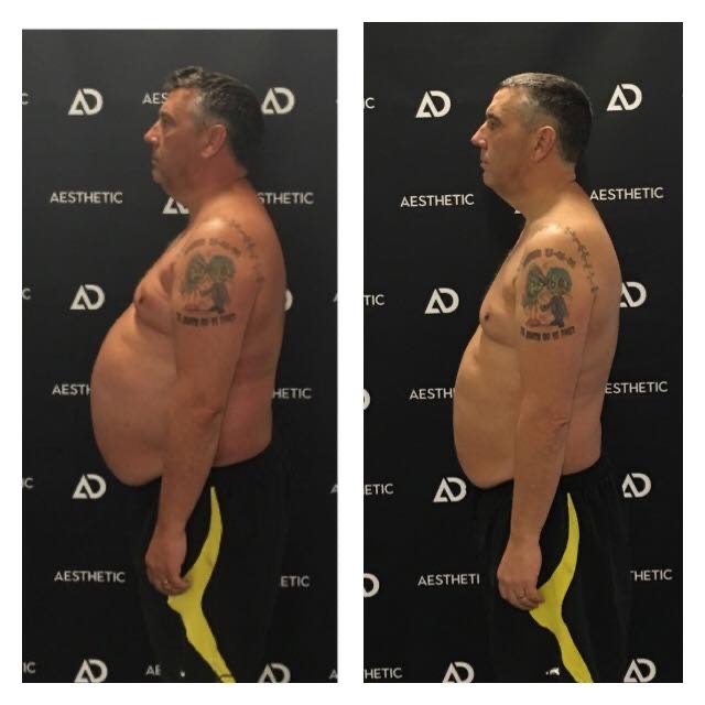 Bolton Personal Training - Personal Trainer Bolton - Personal Training