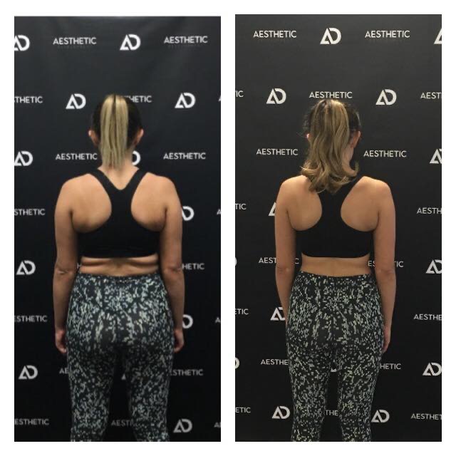 Bolton Personal Training - Personal Trainer Bolton - Personal Training